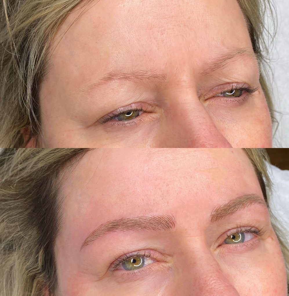 Microblading – Wellness Clinic - Chelmsford, Essex Wellness Clinic ...